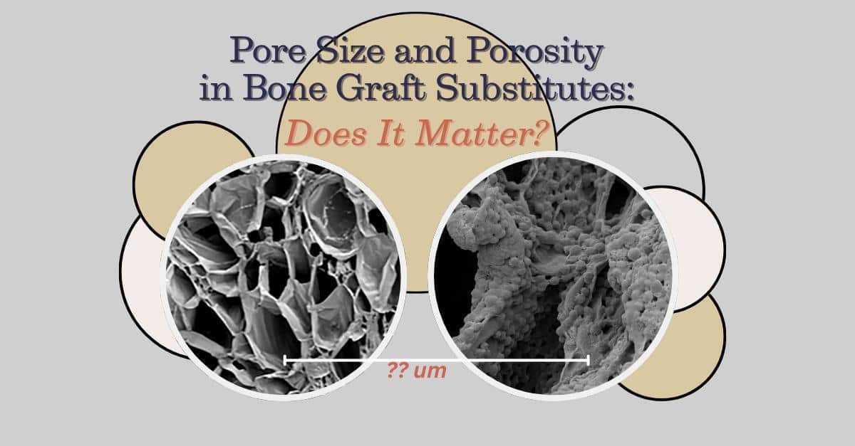 Cracking the Code: How Graft Porosity and Pore Size Unlock Bone Graft ...